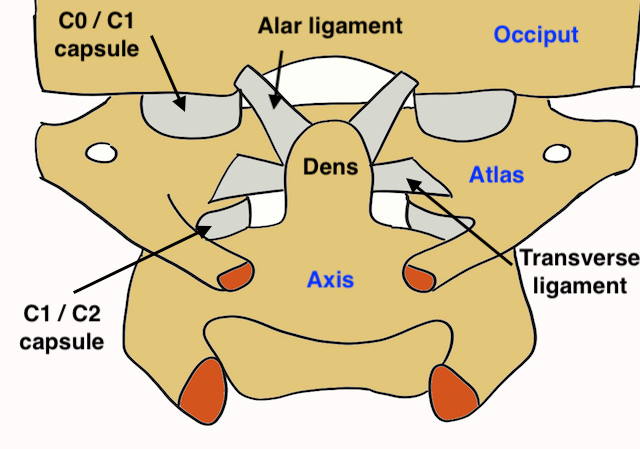Atlanto-axial instability | The Bone School